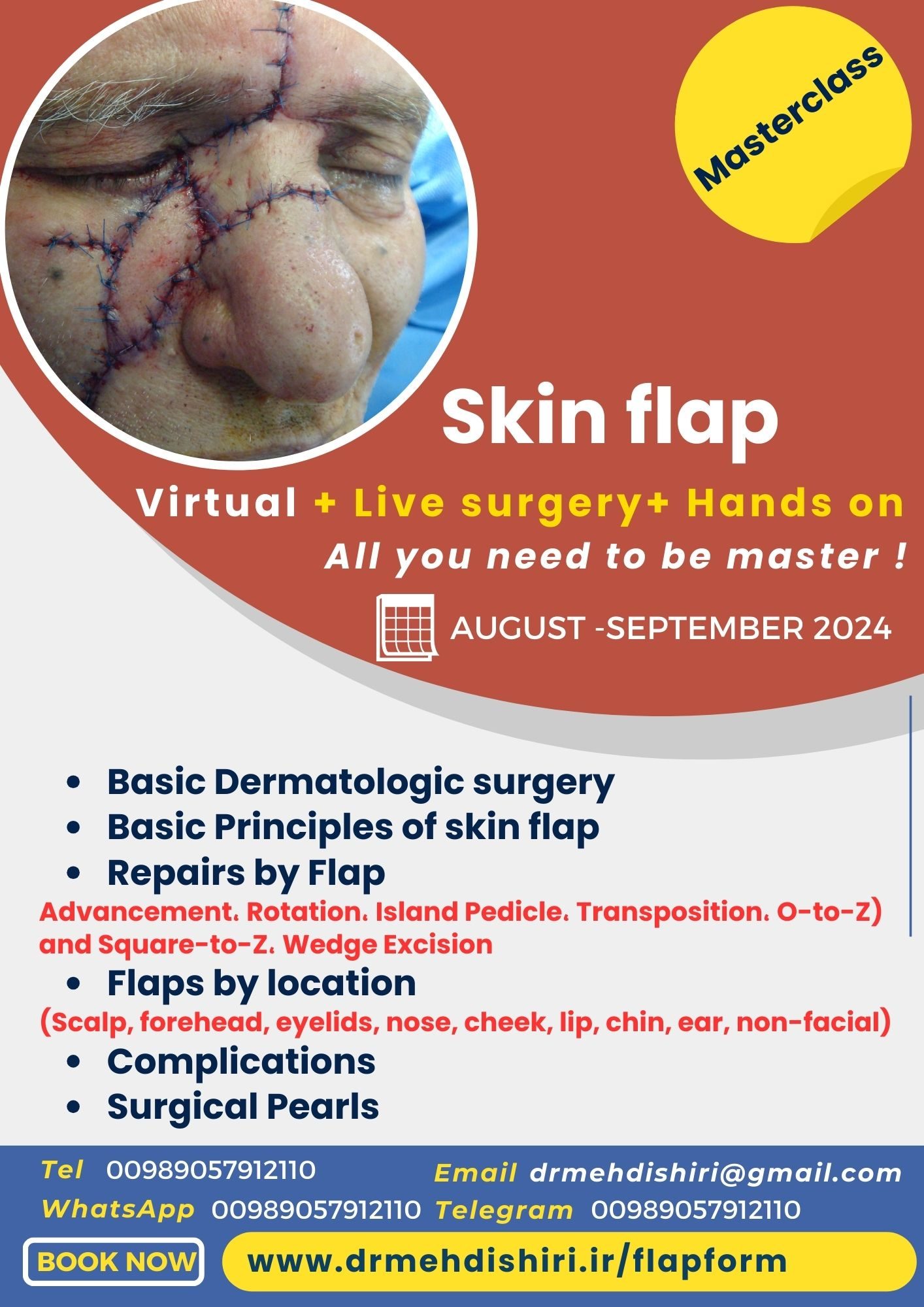 Skin Flap(closed) - دکتر مهدی شیری